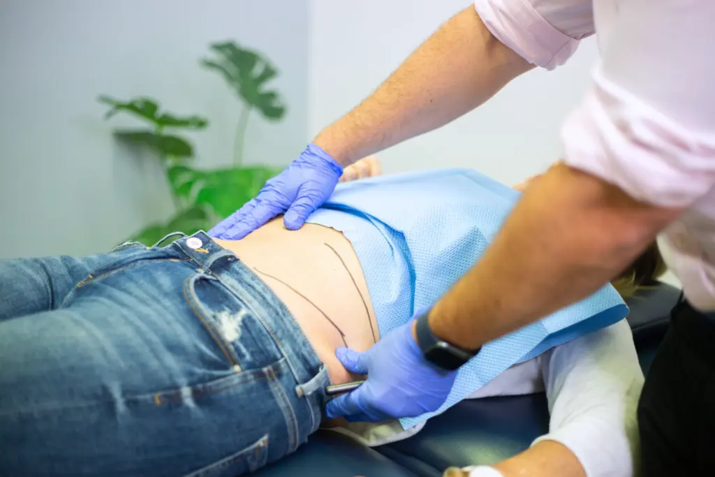 Body Thread Lifting, Non-Surgical Skin Tightening - Dr Ali Cosmetics