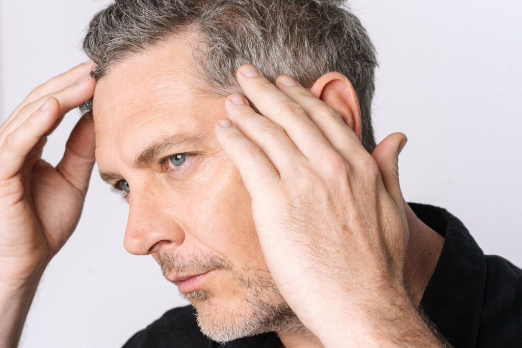 Hair Loss - Dr Ali Cosmetics